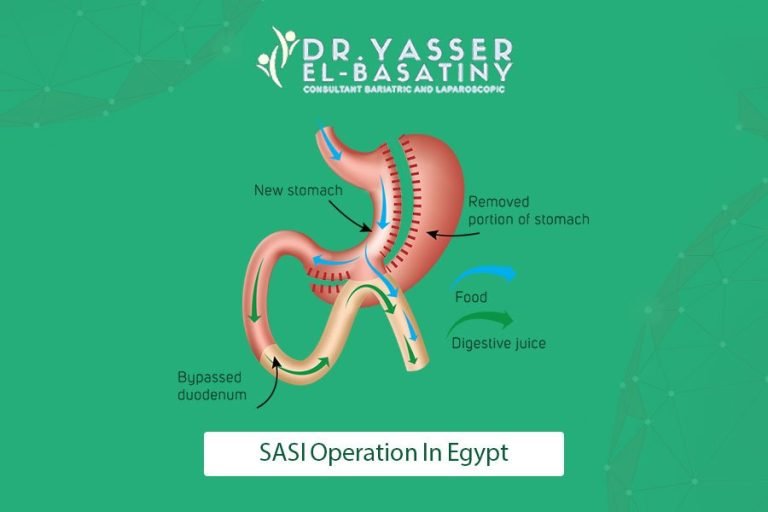 sasi operation in egypt 2025 - Dr. Yasser Al-Basatiny | Senior ...